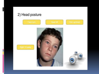 Orthoptic examination | PPTX