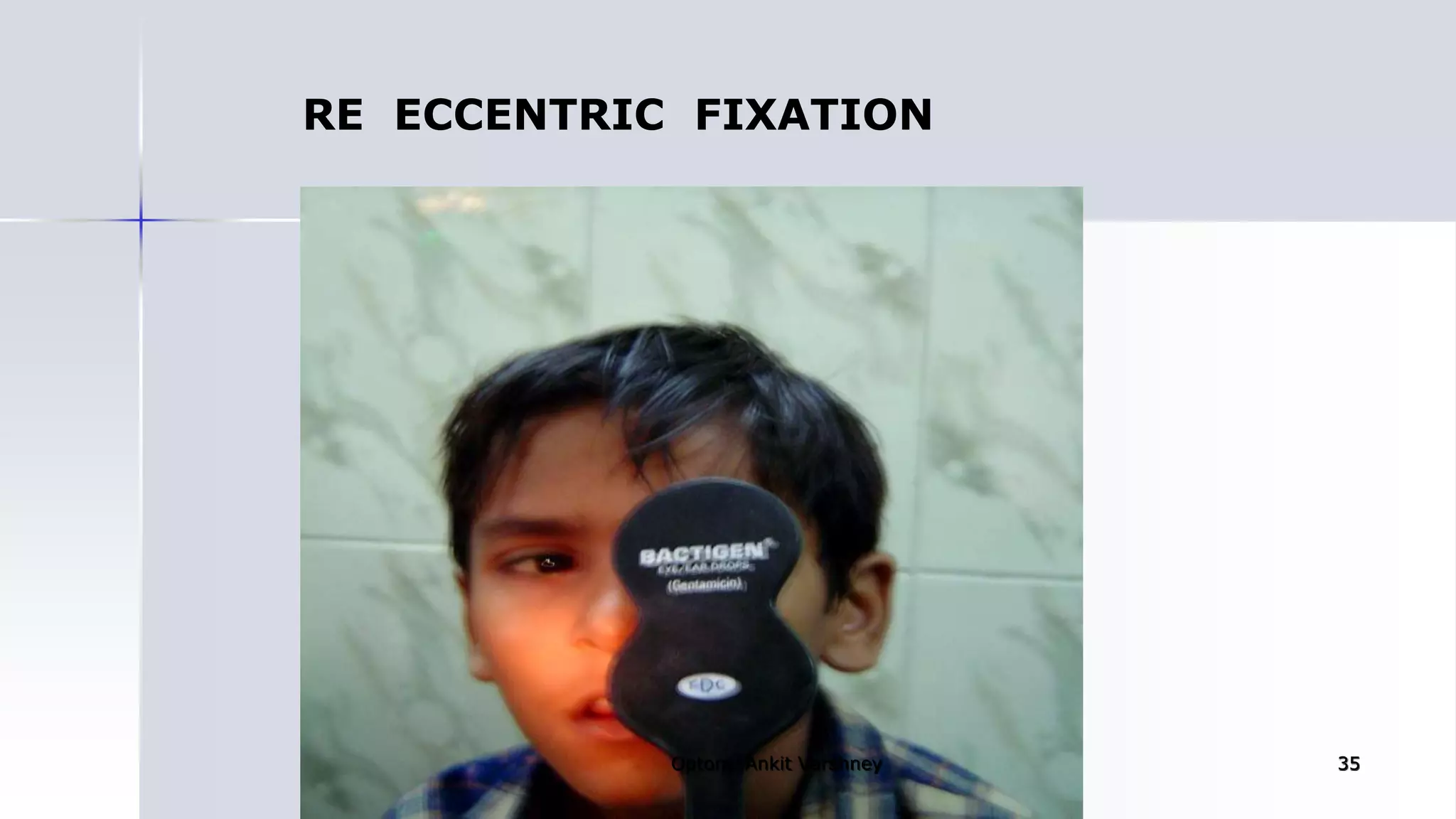 Orthoptics by ankit varshney | PPT