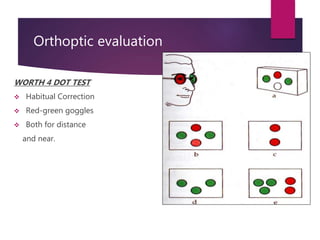 Orthoptics Introduction test | PPTX