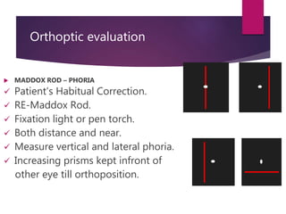 Orthoptics Introduction test | PPTX