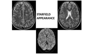 ARDS AND FAT EMBOLISM POST TOTAL HIP REPLACEMENT | PPT