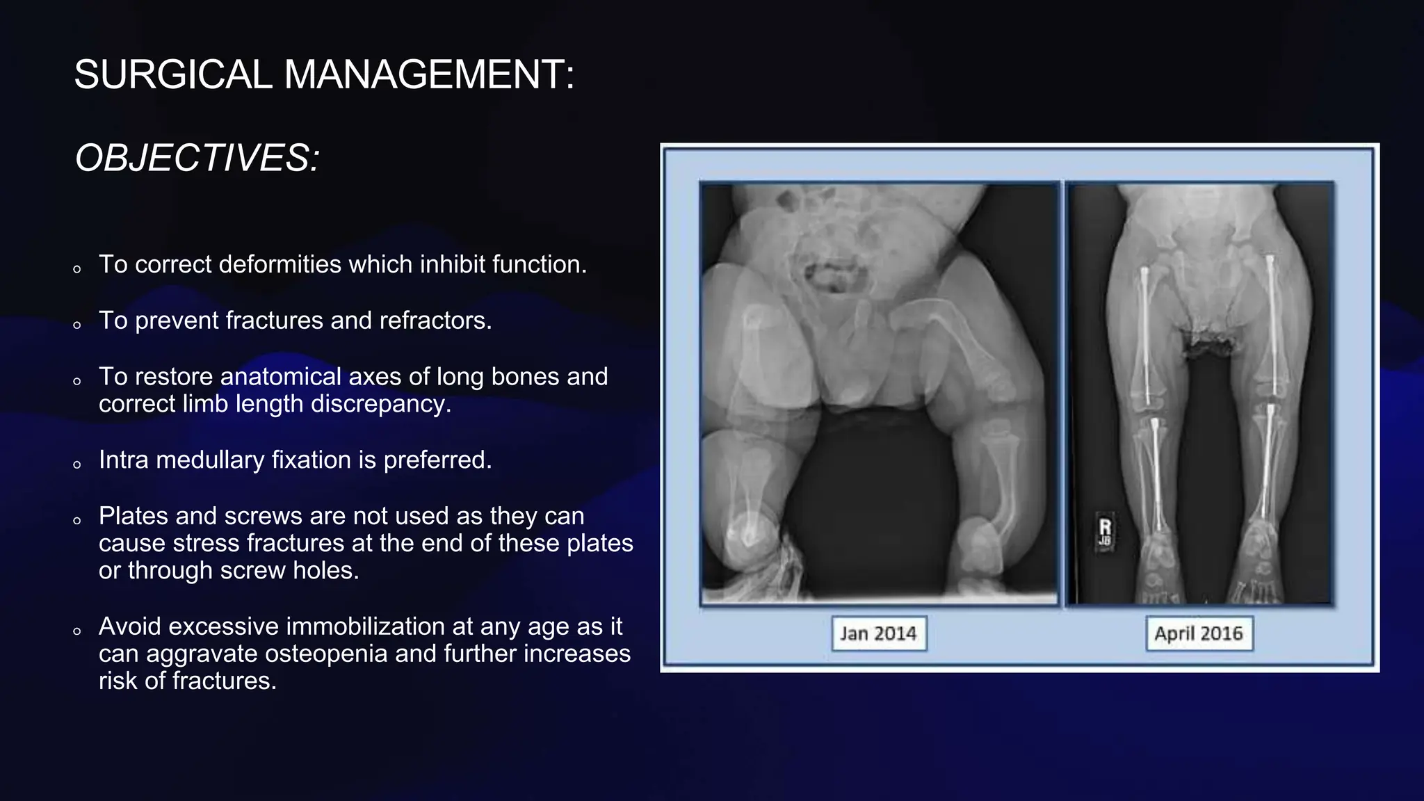 Osteogenesis Imperfecta Etiology Clinical features Classification Management | PPTX