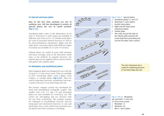 Screws and plates used in orthopaedic trauma fixation | PDF