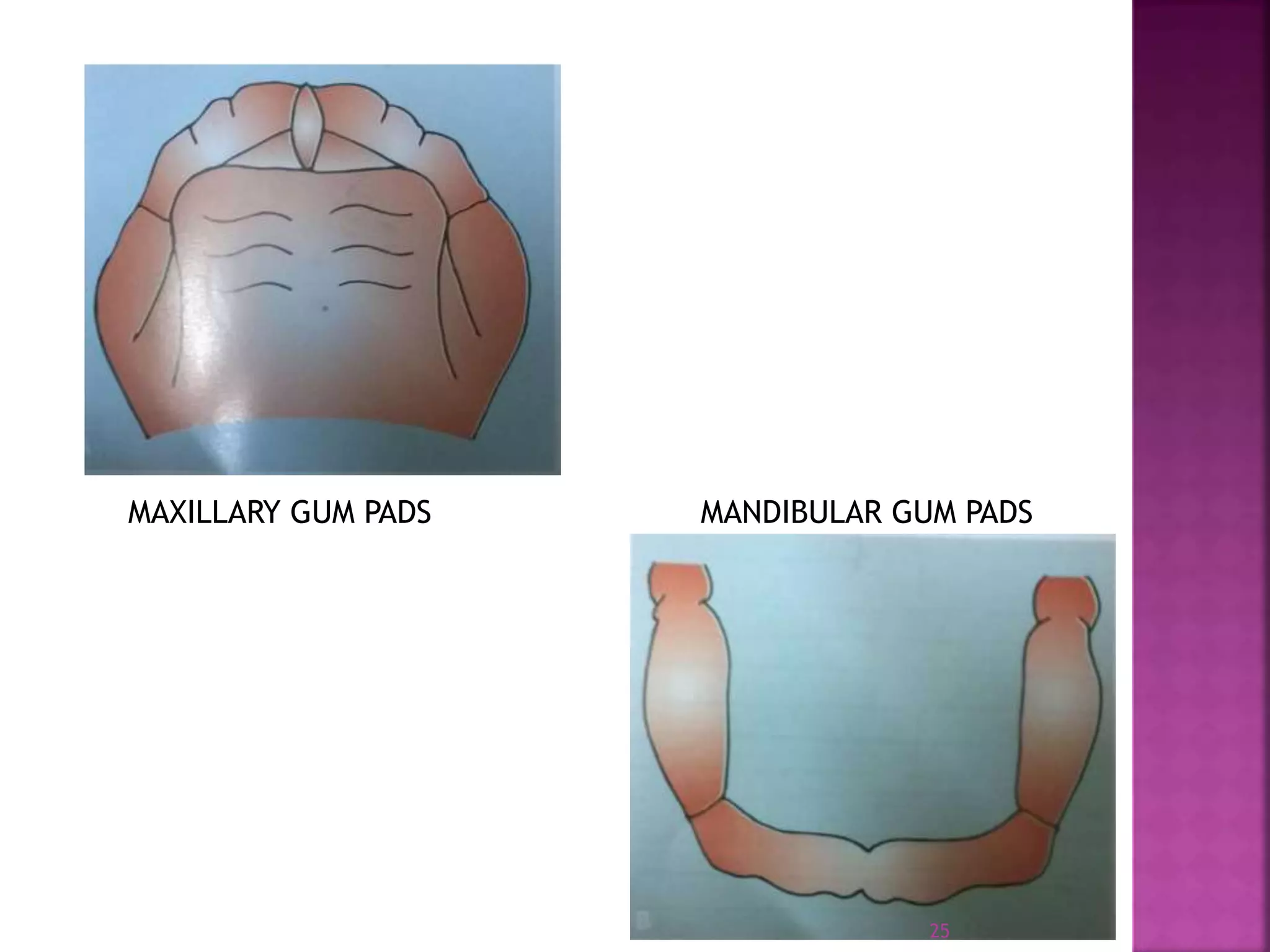 Development of the dentition | PPTX