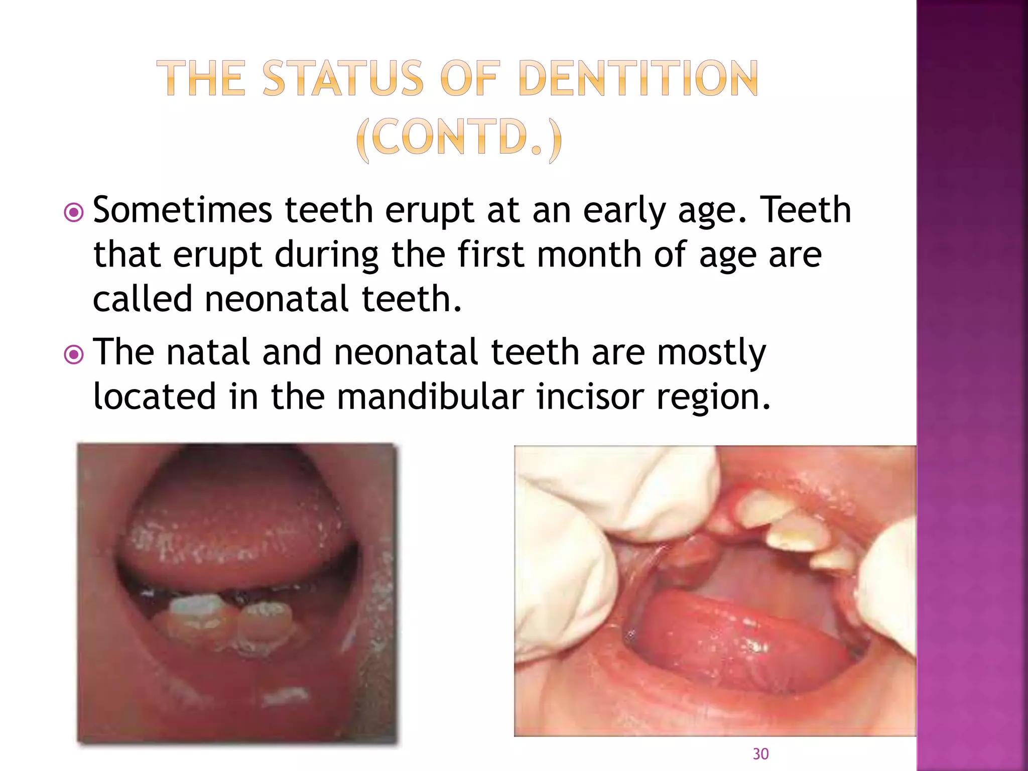 Development of the dentition | PPTX