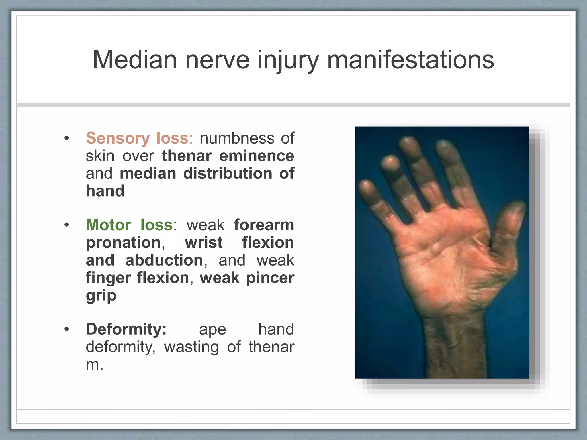 Peripheral nerve injuries | PPTX