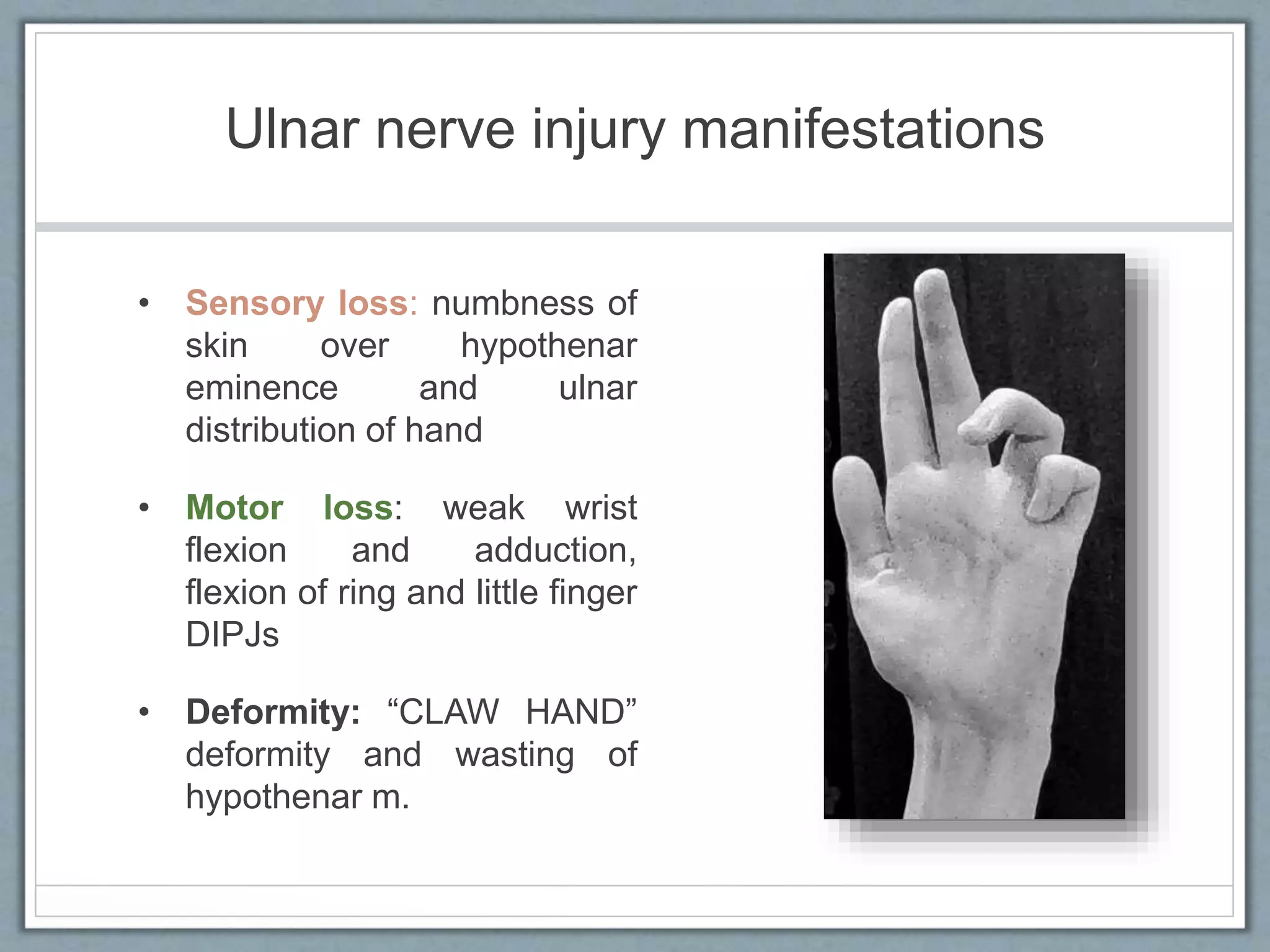 Peripheral nerve injuries | PPTX