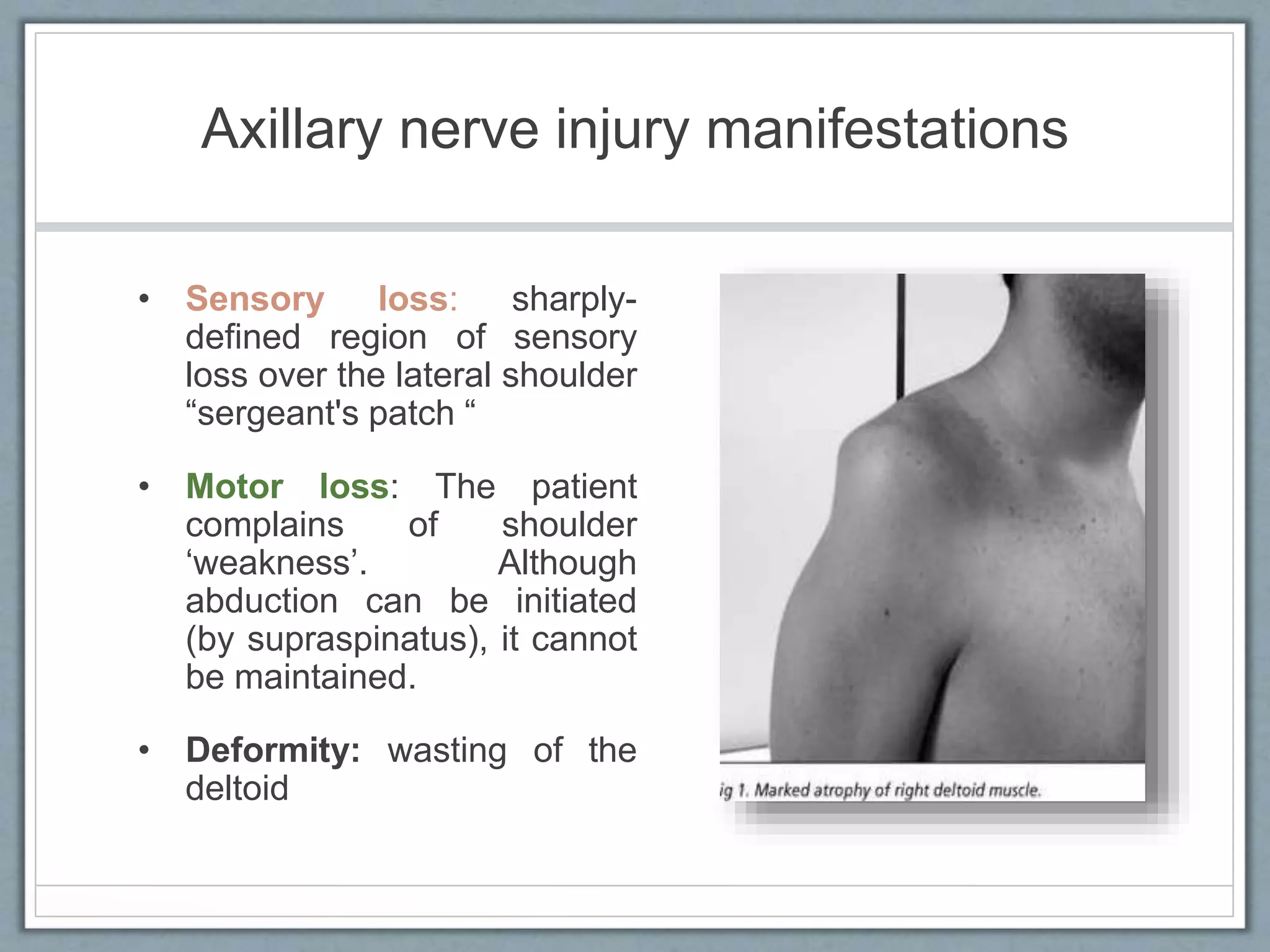 Peripheral nerve injuries | PPTX