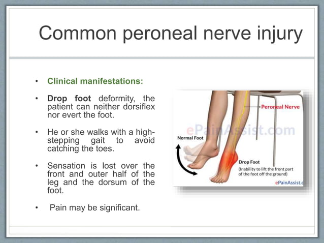 Peripheral nerve injuries | PPTX