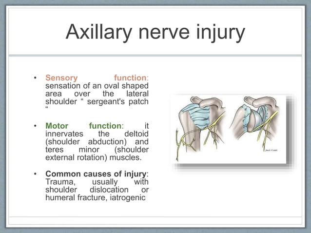 Peripheral nerve injuries | PPTX