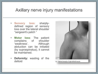 Peripheral nerve injuries | PPTX