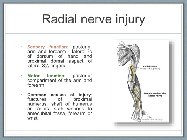 Peripheral nerve injuries | PPTX