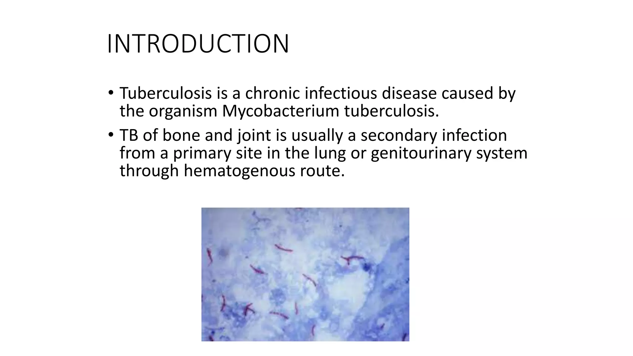 Skeletal Tuberculosis Orthopaedics Seminar | PPTX
