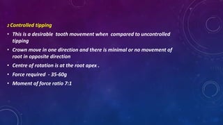 ortho seminar biomechanics of tooth movement | PPTX
