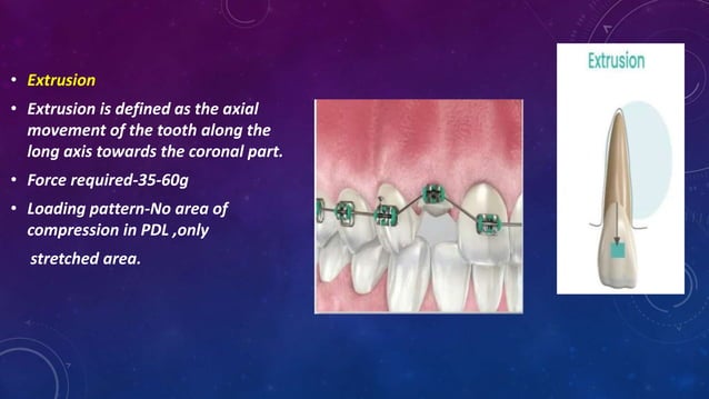 ortho seminar biomechanics of tooth movement | PPTX | Dental Health ...