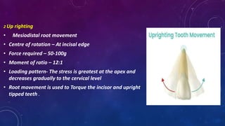ortho seminar biomechanics of tooth movement | PPTX | Dental Health ...
