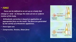 ortho seminar biomechanics of tooth movement | PPTX | Dental Health ...