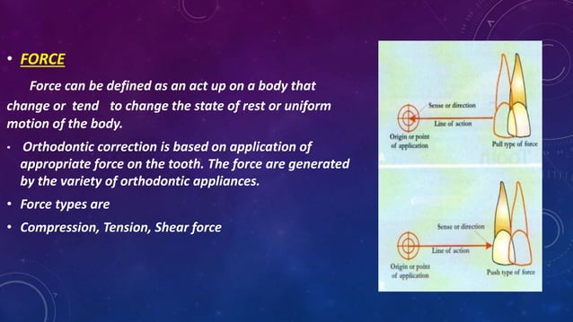 ortho seminar biomechanics of tooth movement | PPTX | Dental Health ...