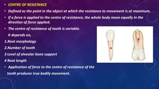 ortho seminar biomechanics of tooth movement | PPTX | Dental Health ...