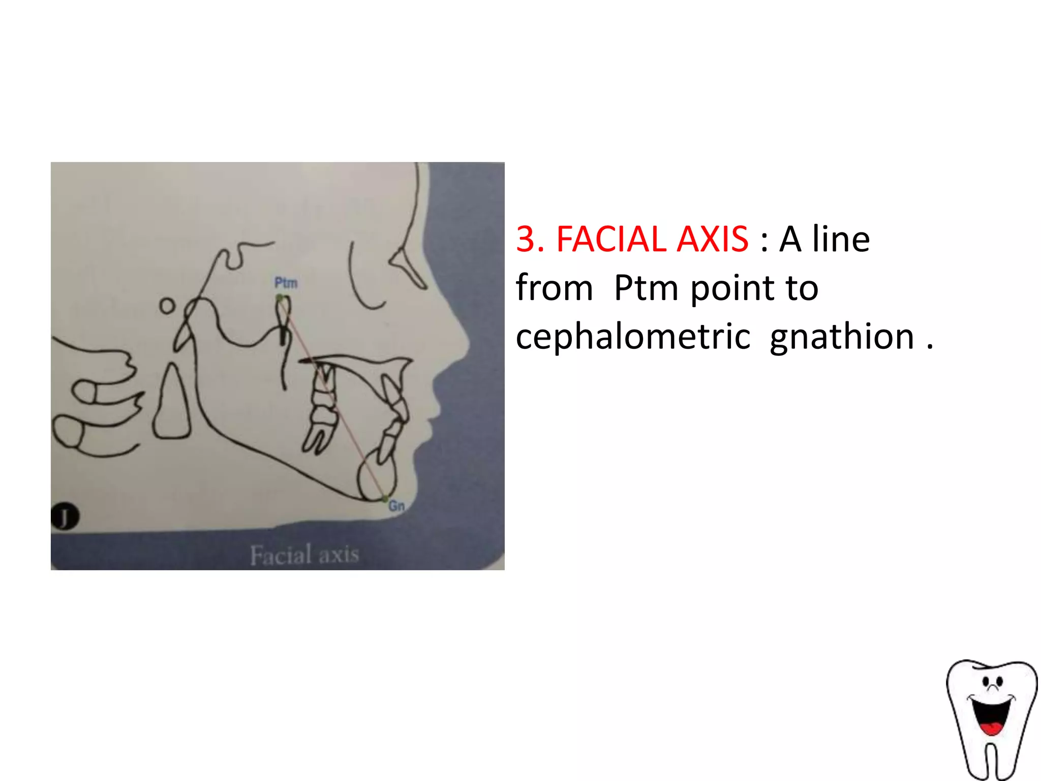 Cephalometrics ( landmarks,Lines and Planes ) | PPTX