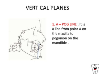 Cephalometrics ( landmarks,Lines and Planes ) | PPTX
