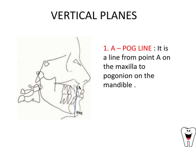 Cephalometrics ( landmarks,Lines and Planes ) | PPTX | Ear, Nose and ...