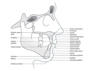 3d Cephalometric Landmarks Used In This Study Were Marked On The Skull