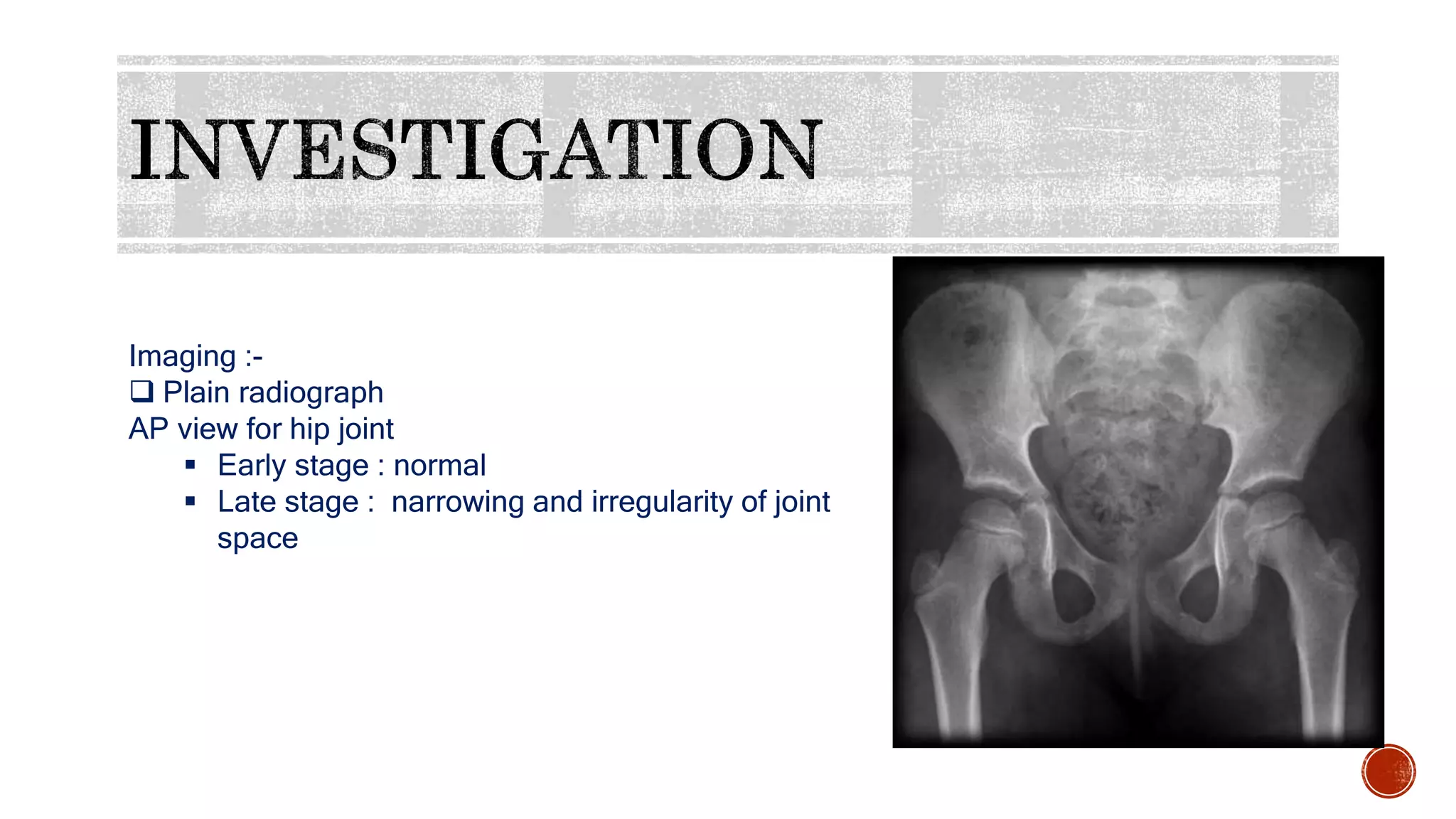 Approach to child with leg pain-Septic arthritis | PPTX