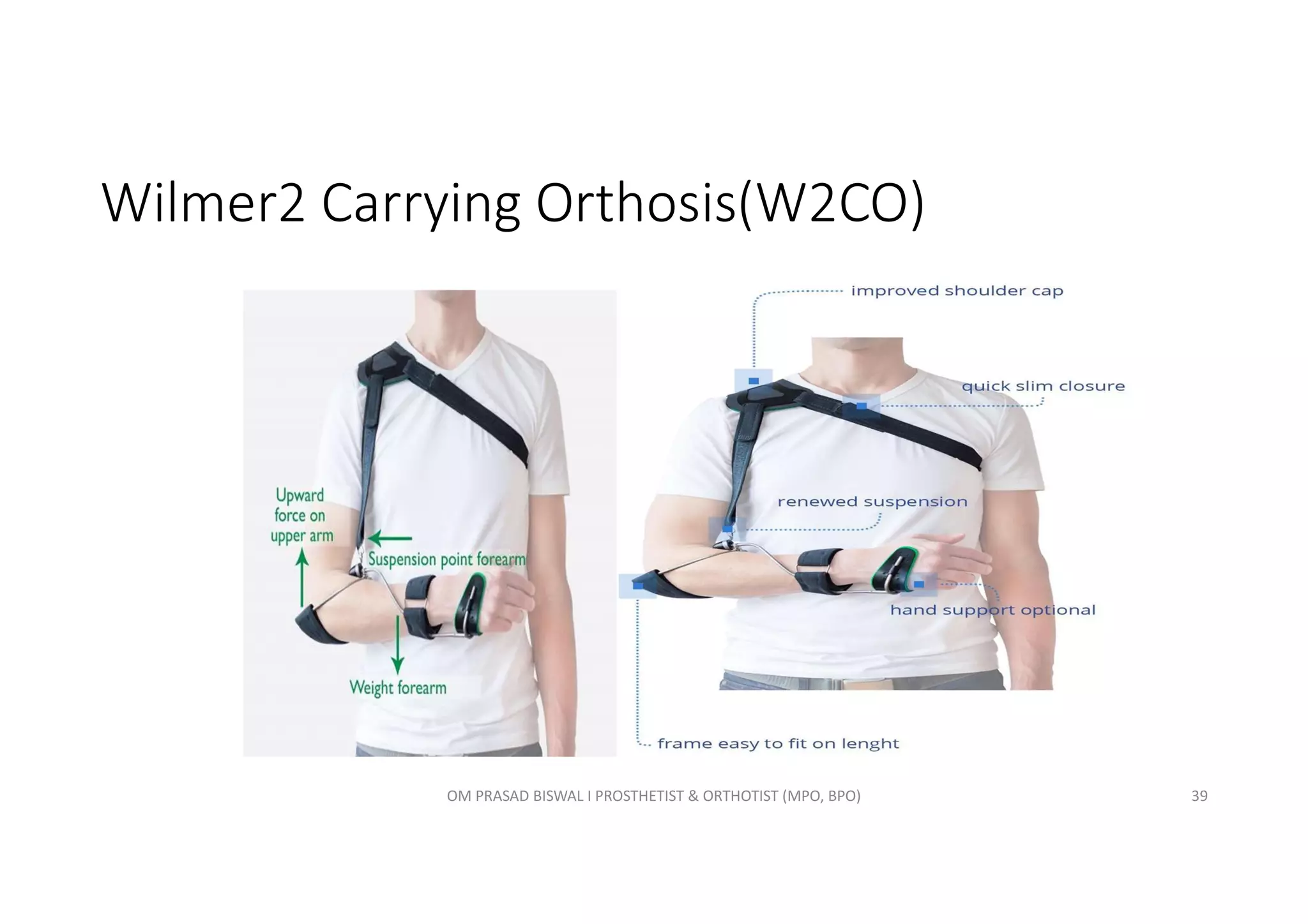 Orthoses for shoulder, elbow and forearm | PDF
