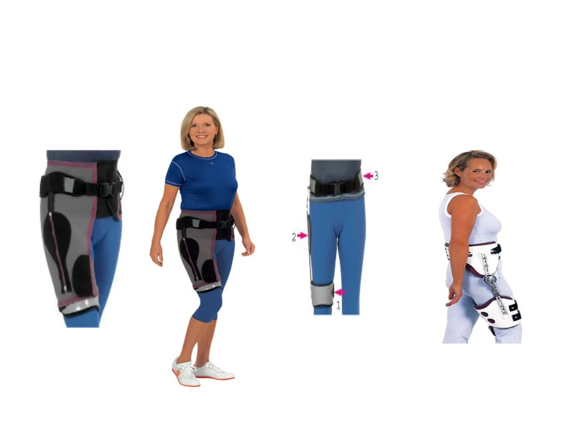 Compressive Forces: Biomechanical aspect of orthosis | PPT