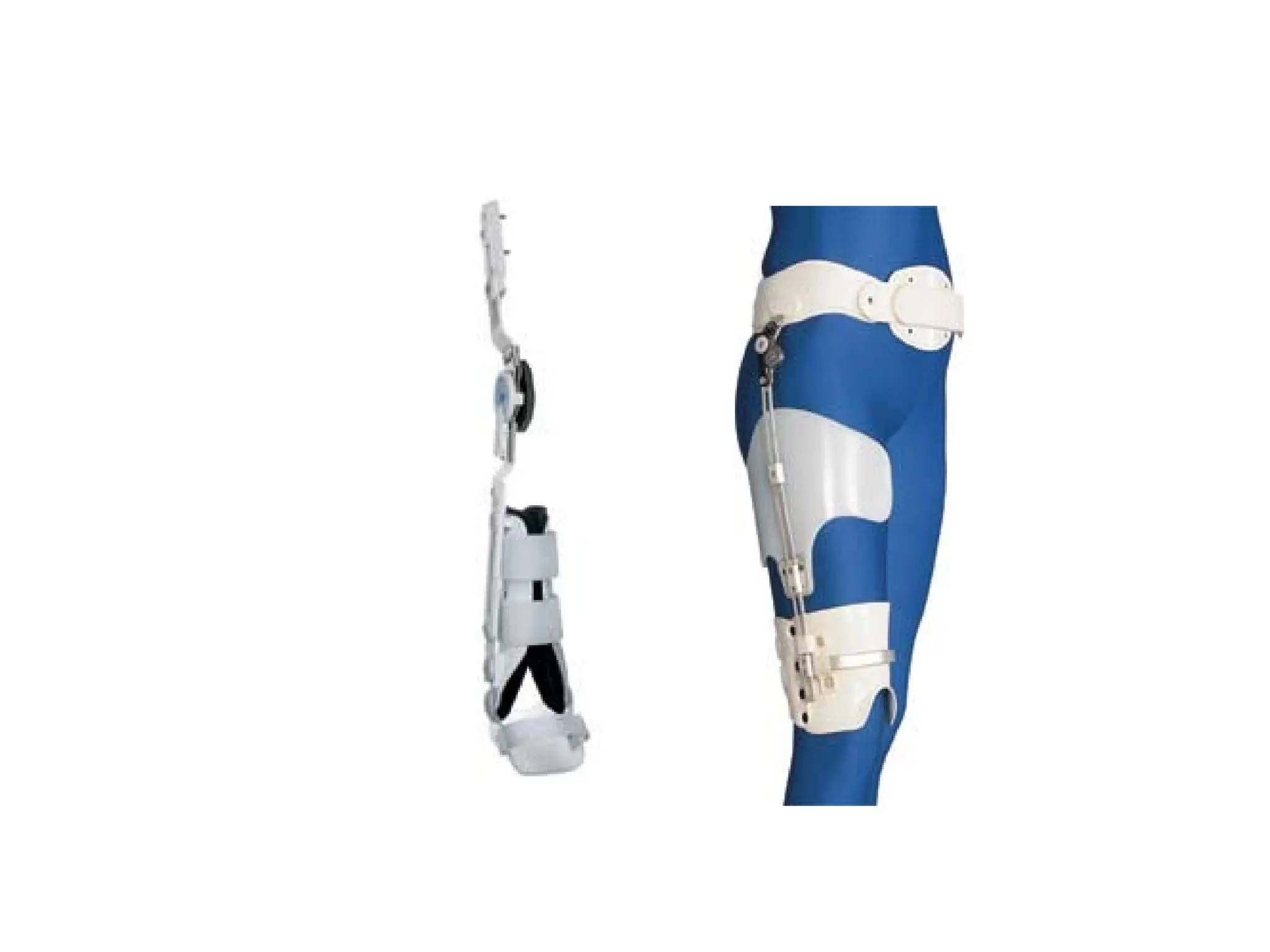 Compressive Forces: Biomechanical aspect of orthosis | PPT