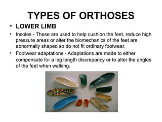 Compressive Forces: Biomechanical aspect of orthosis | PPT