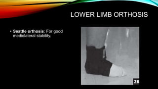 orthosis hbk.pptx