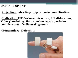 Orthosis of hand ppt | PPT