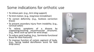 Introduction to Orthosis.pptx | Death, Injury, or Military Conflict ...