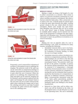 Ortho spinting casting | PDF