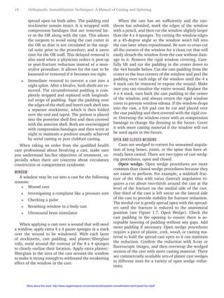 Ortho spinting casting | PDF