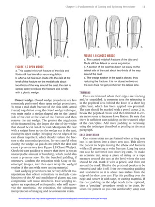 Ortho spinting casting | PDF