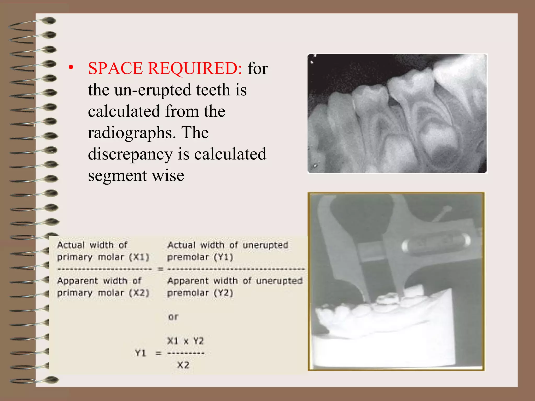 Ortho study model analysis | PPT