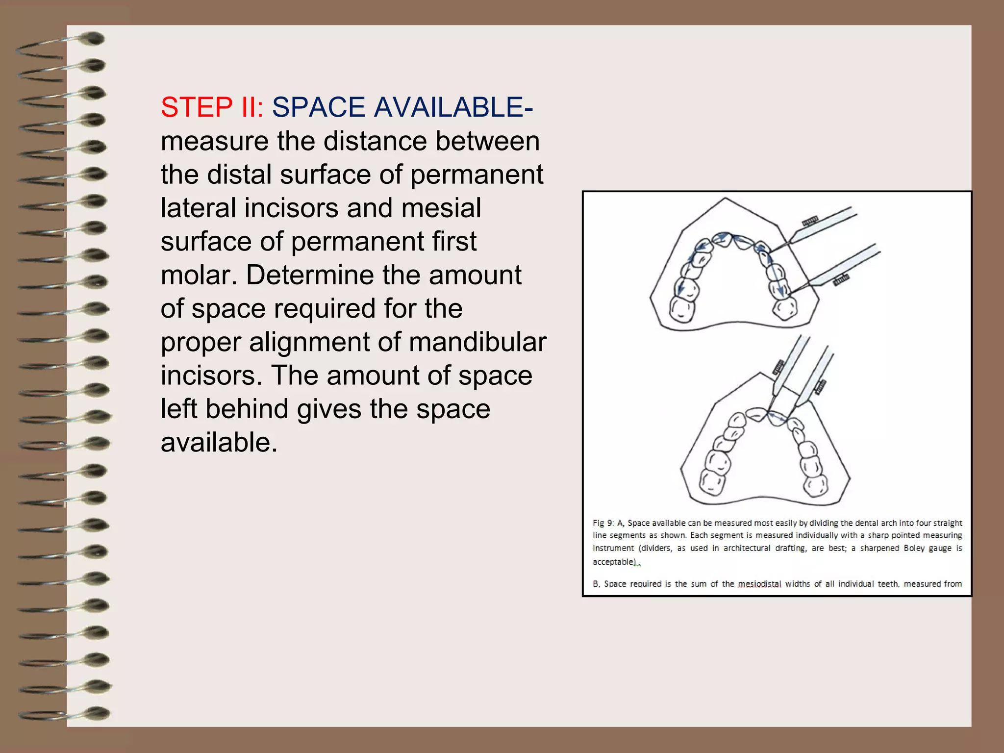 Ortho study model analysis | PPT