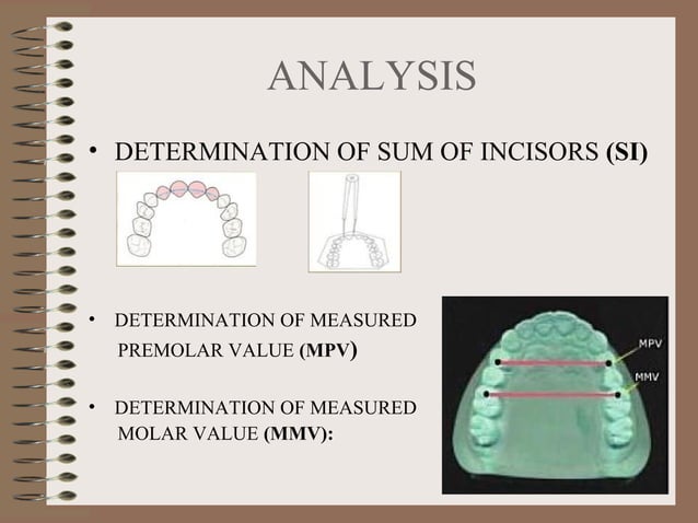 Ortho study model analysis | PPT