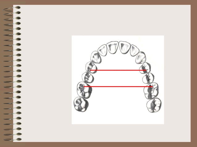 Ortho study model analysis | PPT | Dental Health | Diseases and Conditions