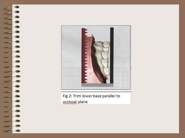 Ortho study model analysis | PPT | Dental Health | Diseases and Conditions