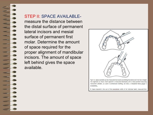 Ortho study model analysis | PPT | Dental Health | Diseases and Conditions