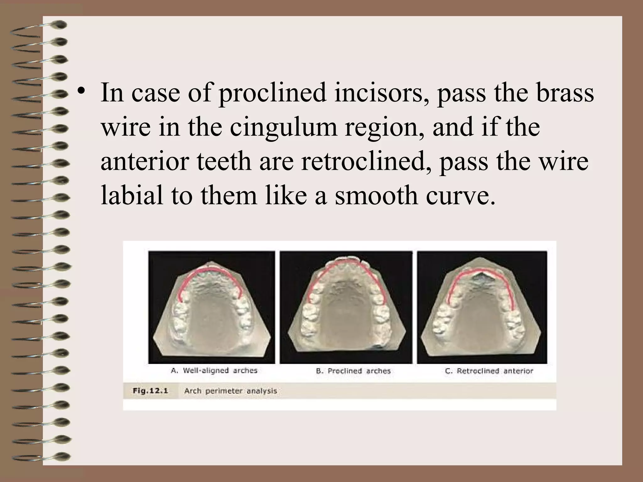 Orthodontic Study Model Analysis | PPT