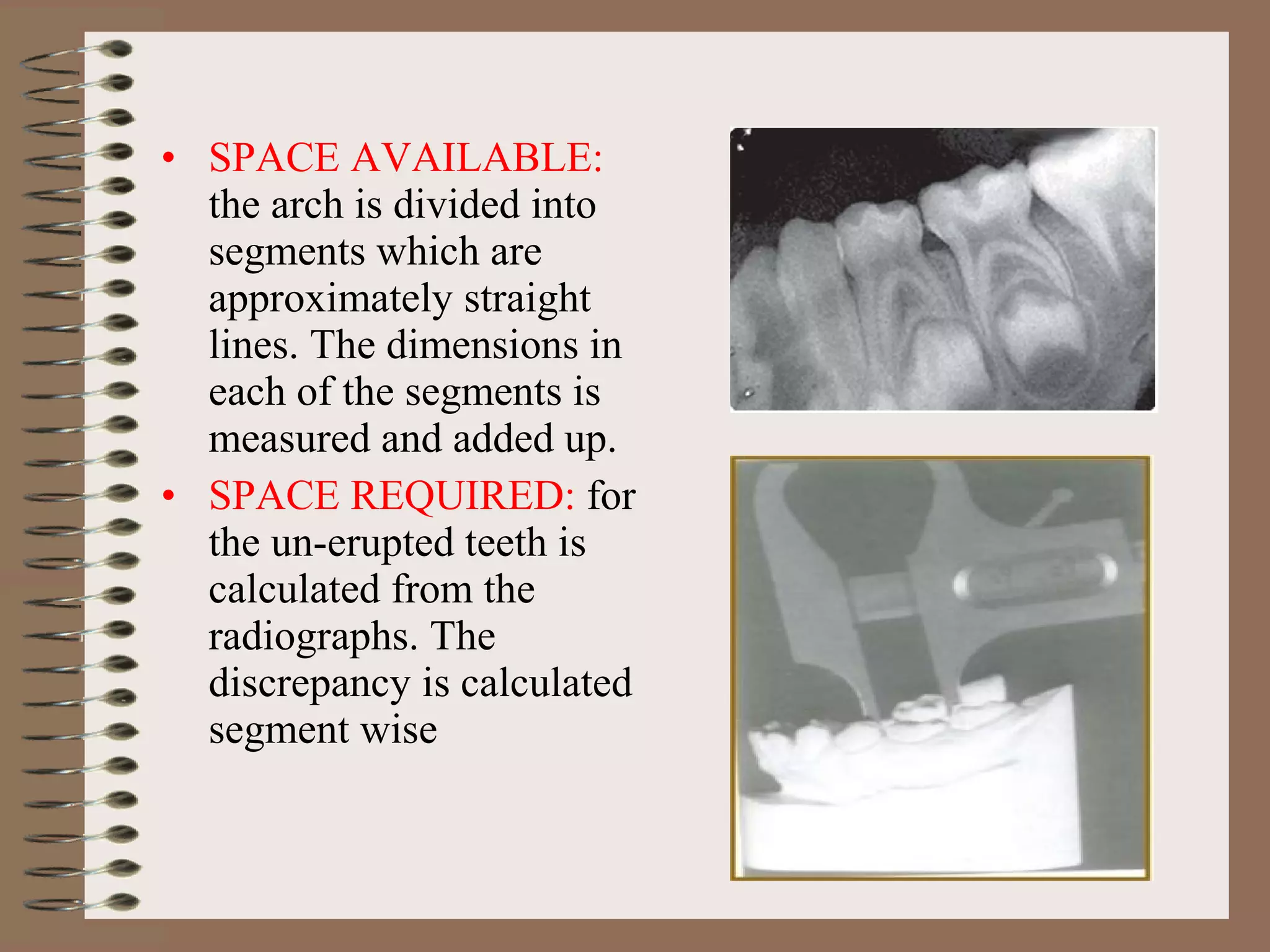 Orthodontic Study Model Analysis | PPT