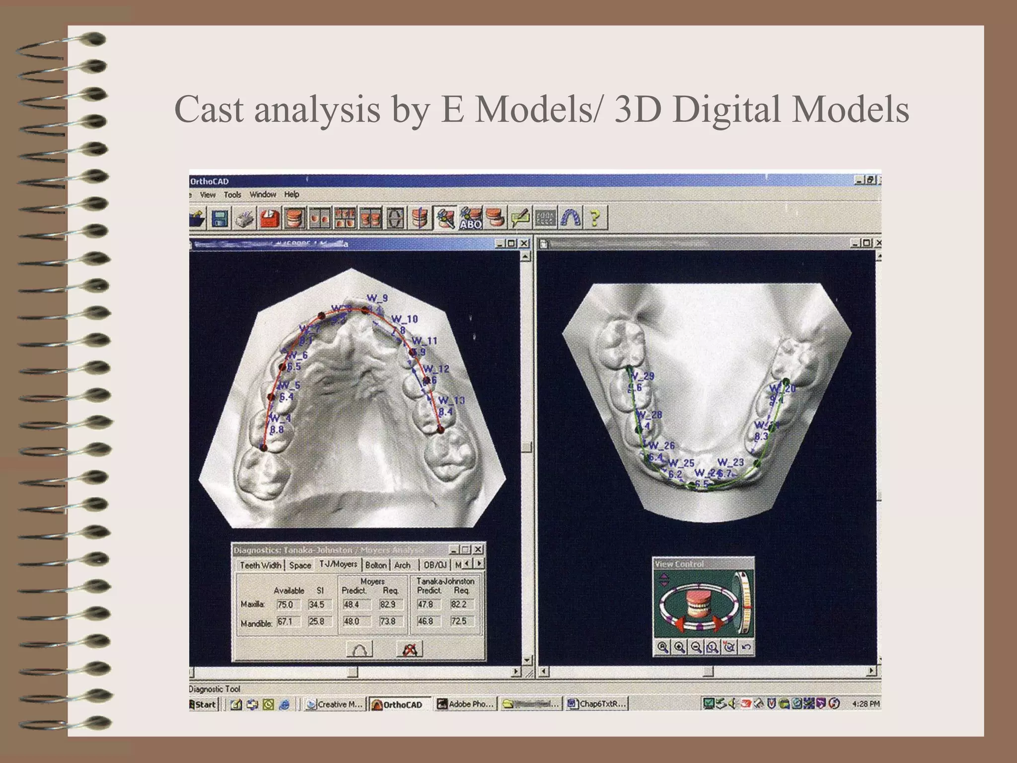 Orthodontic Study Model Analysis | PPT