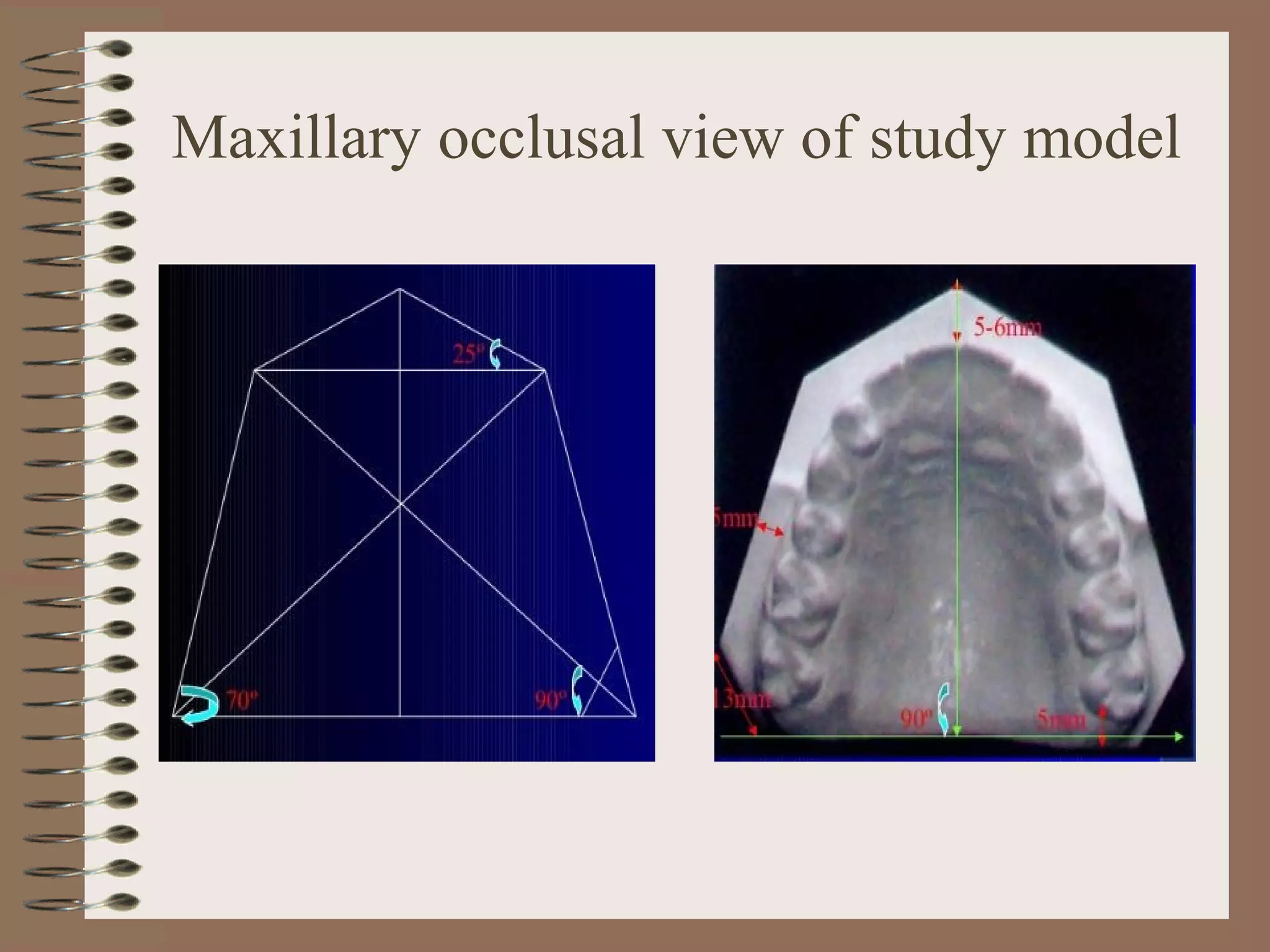 Orthodontic Study Model Analysis | PPT