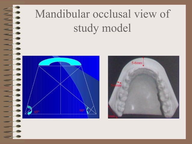 Orthodontic Study Model Analysis | PPT | Dental Health | Diseases and ...