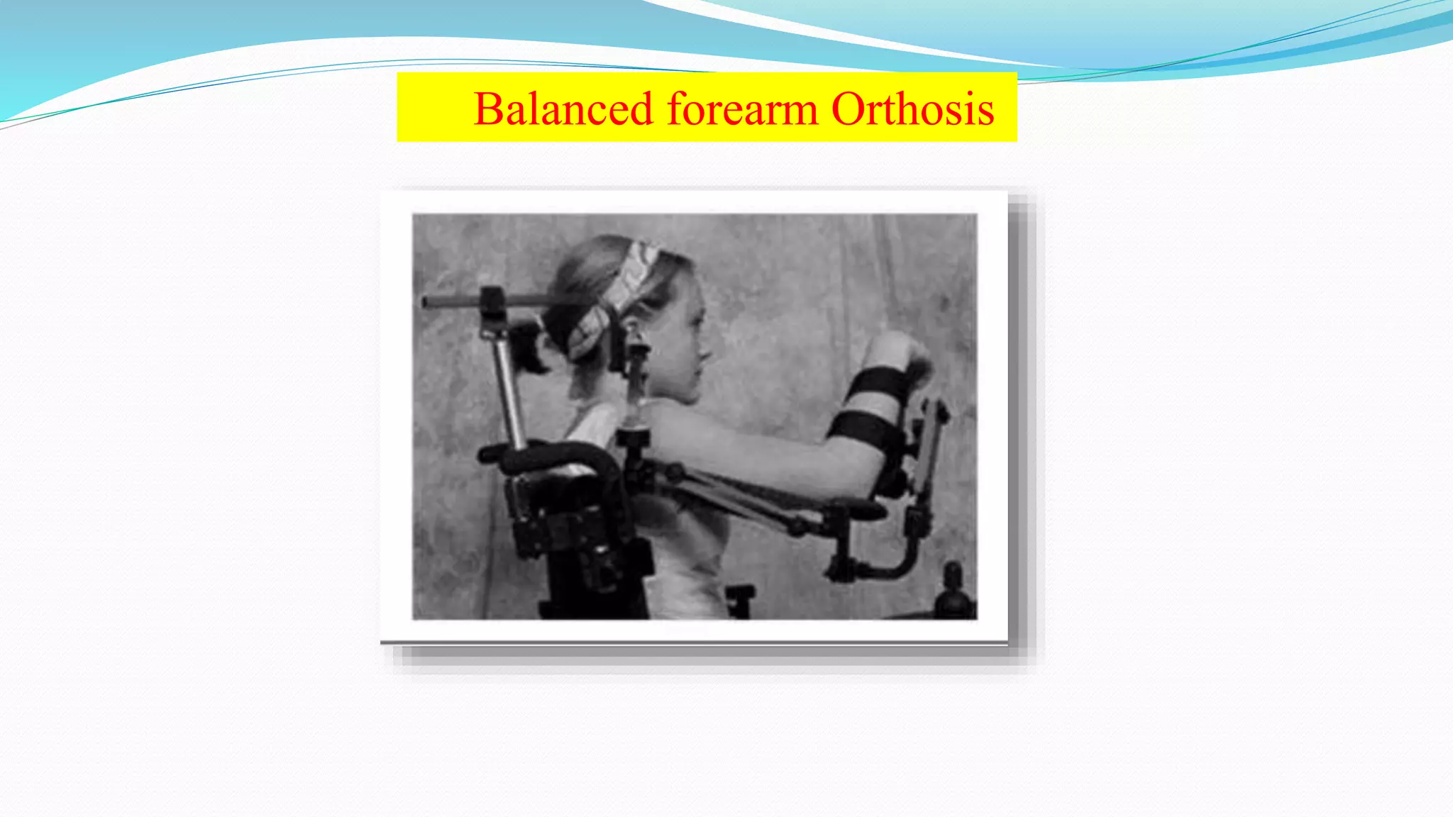 Orthotic assessment & orthotic aids in sci | PPTX